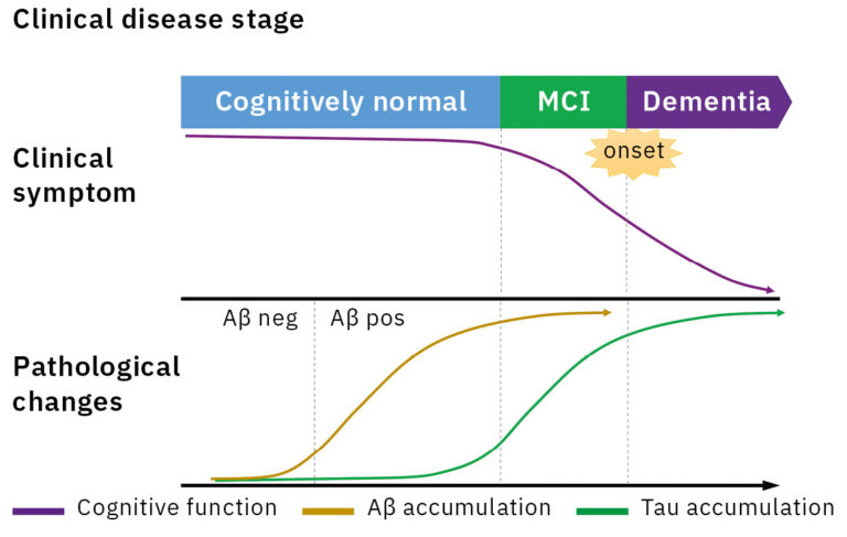 MS detection of Alzheimer’s blood-based biomarkers – secrets of science